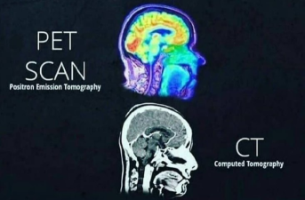 Apa perbedaan MRI , MRA , Pet Scan, CT Scan dan X-Ray ? – PACS Indonesia