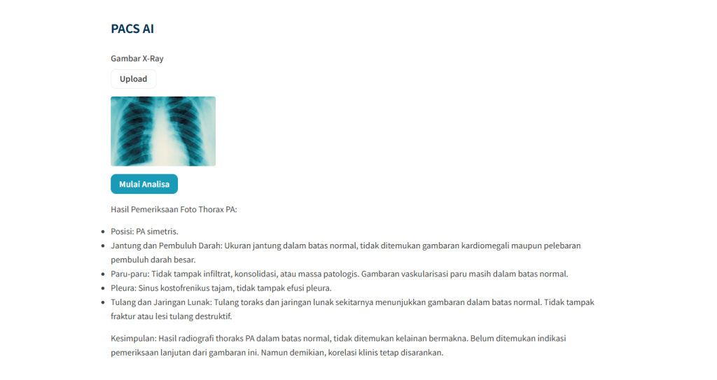 PACS Indonesia Ujicoba AI untuk Foto Thorax dari X-Ray – PACS Indonesia